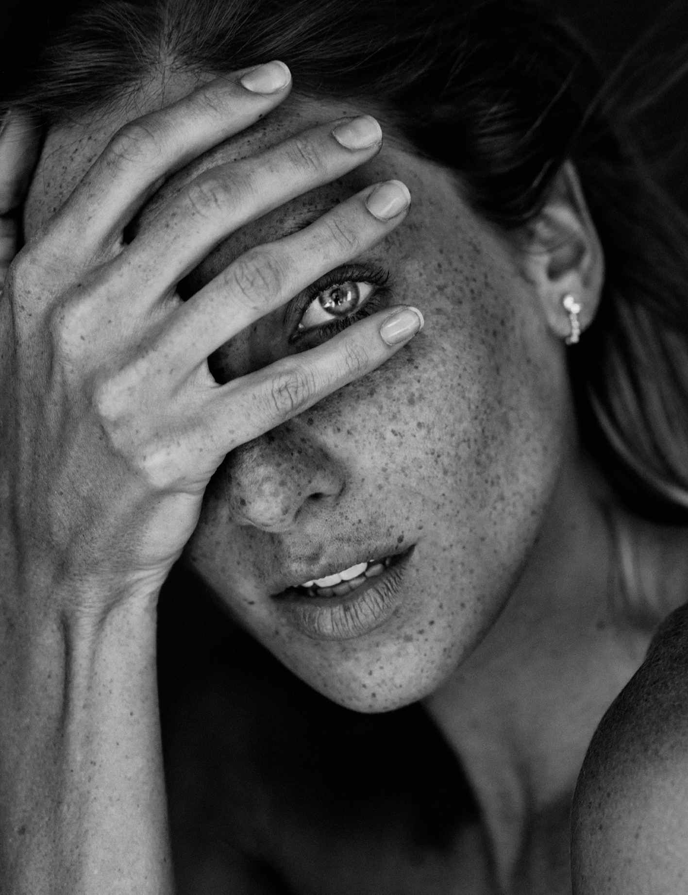 Carsten Witte - The Freckles Project